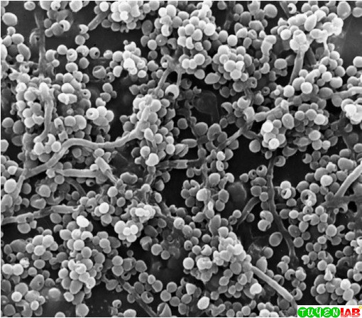 [Microbiology] Atlas of Ocular Infections | Free Medical Atlas