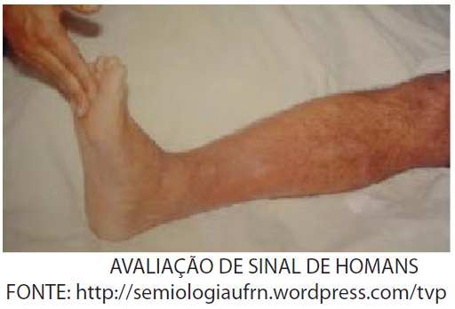 Dicas de Enfermagem: Teste para confirmação de Trombose Venosa Profunda ...