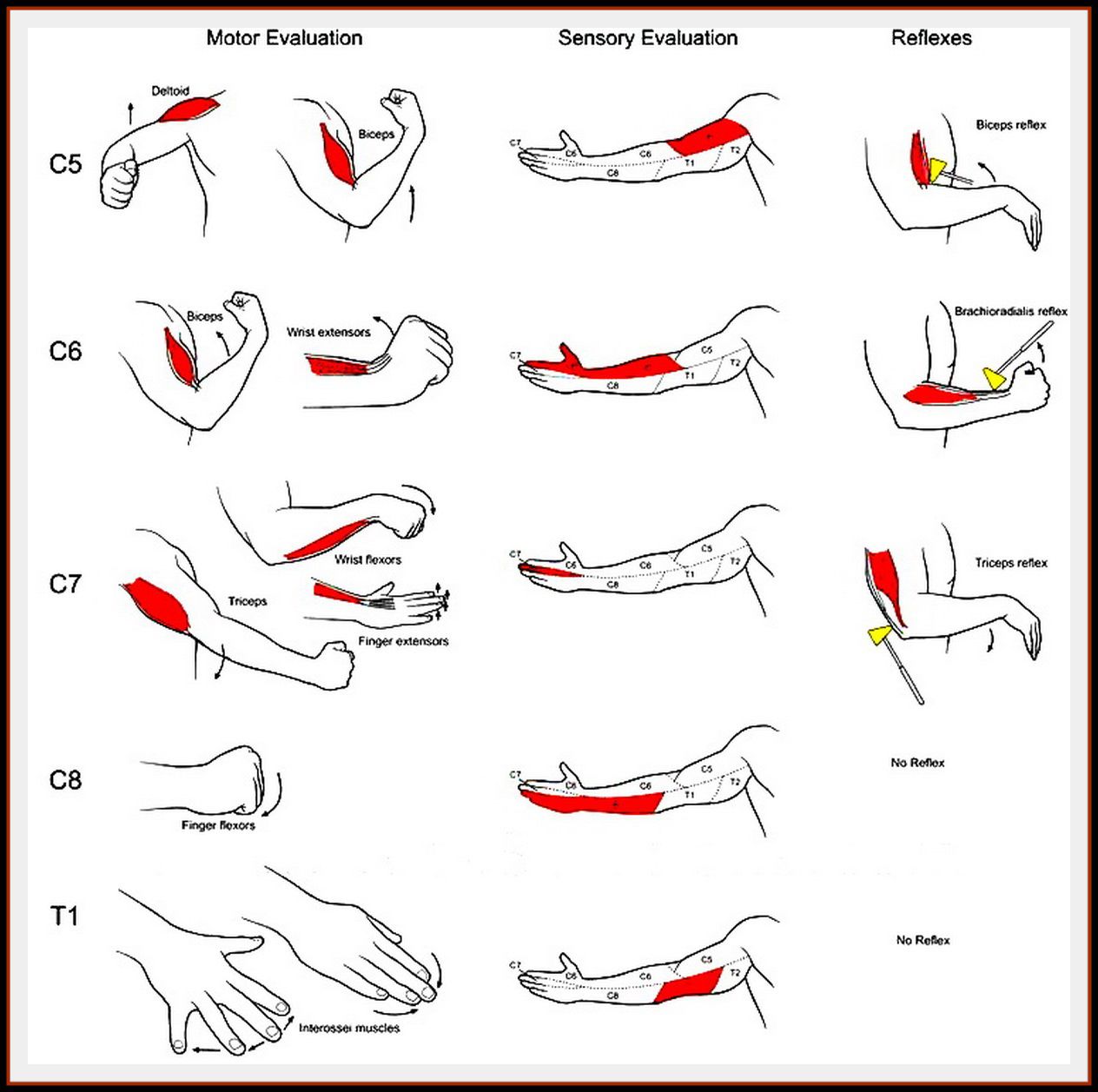 truthlady3: Dermatomes Dermal Segmentation