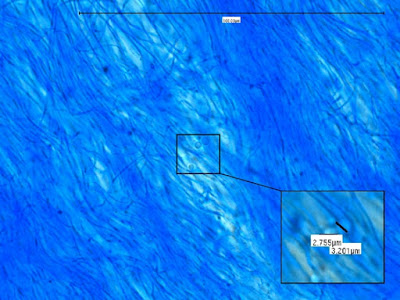 Fun With Microbiology (What's Buggin' You?): Sarocladium kiliense