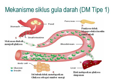 AL_BASHRI: Diabetes Mellitus