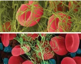 Ciencias de Joseleg: Las plasmina y la fibrinólisis