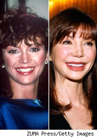 Victoria Principal Plastic Surgery