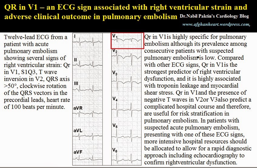 Dr.Nabil Paktin's Journal of Cardiovascular Medicine Blog ژورنال ( قلب ...