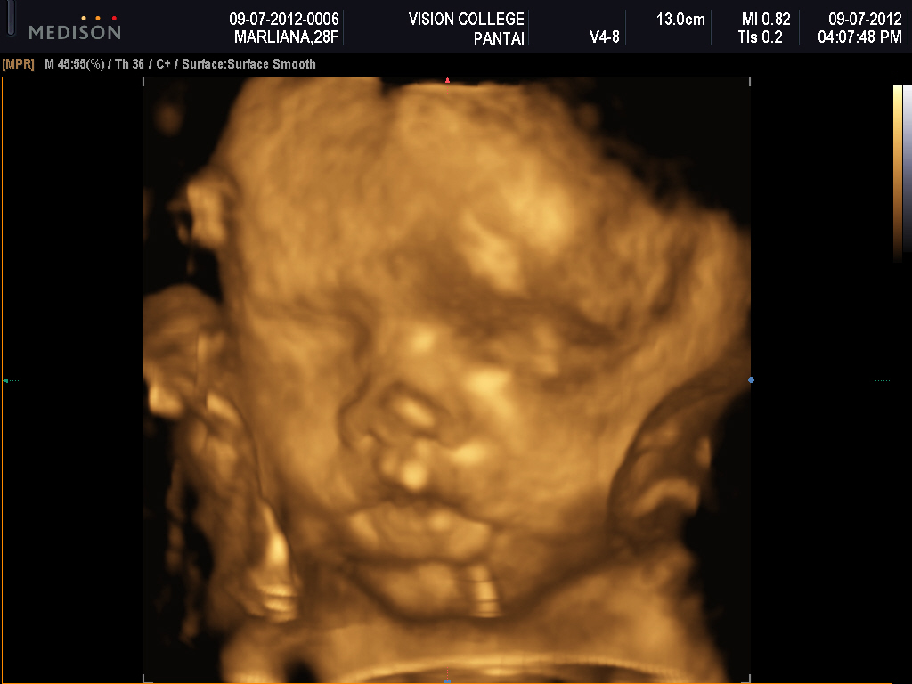 My Simple but Nice Life: 3D/ 4D Scan Baby Scan - 26 Weeks Di Vision College