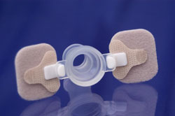 My Voice: Heat moisture exchanger (HME) filter care in laryngectomees