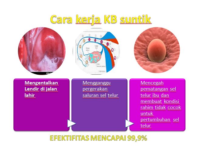 ABPK KB SUNTIK 3 BULAN: ABPK KB SUNTIK 3 BULAN