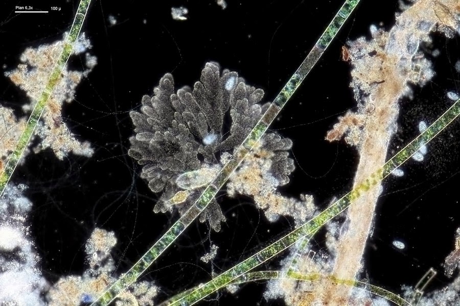 Microbiología: Pseudomonas