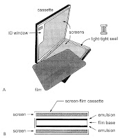 X-ray cassette - radiology health