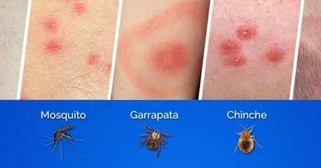 Picaduras De Chinches Fotos