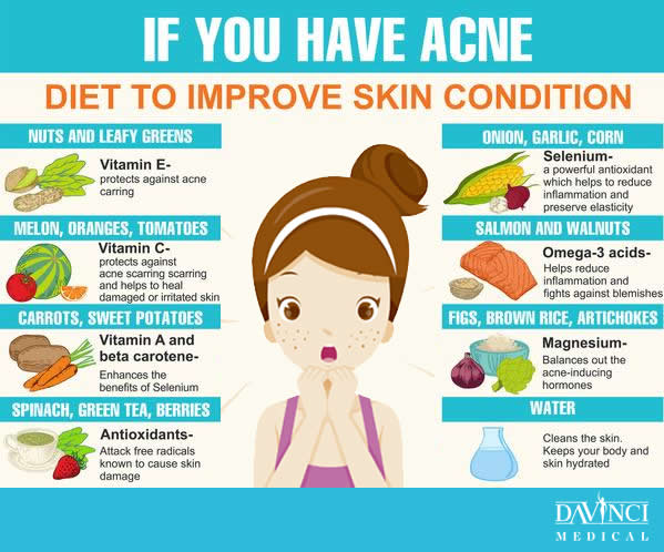 Angel Belle Faith: Secret and Tips for Acne Prevention #ad #davinciclinic