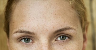 5 tratamientos contra las manchas que debes conocer | ME PASO EL DIA ...