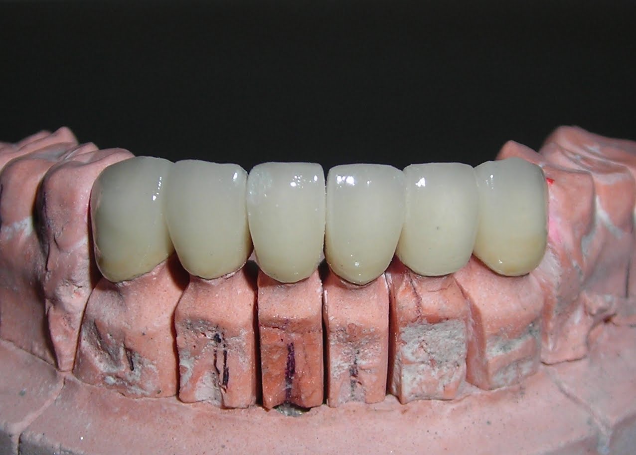 Restorative Dentistry & Endodontics: March 2011