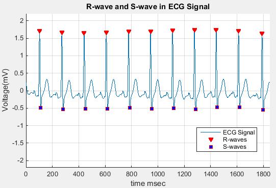 Biomedical Signal And Image Processing Projects Using Matlab And Labview Tools Matlab Code To