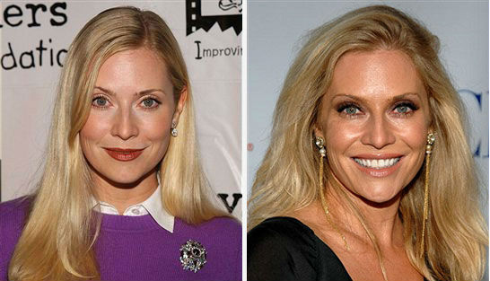 Emily Procter Surgery