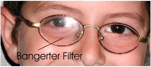 Cátedra N° 22 - Seminario N° 12 "Tratamientos de ambliopía"