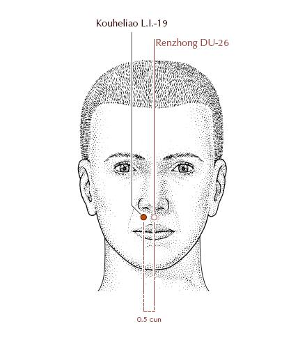 Acupuncture: LI - 19 (Large Intestine-19)