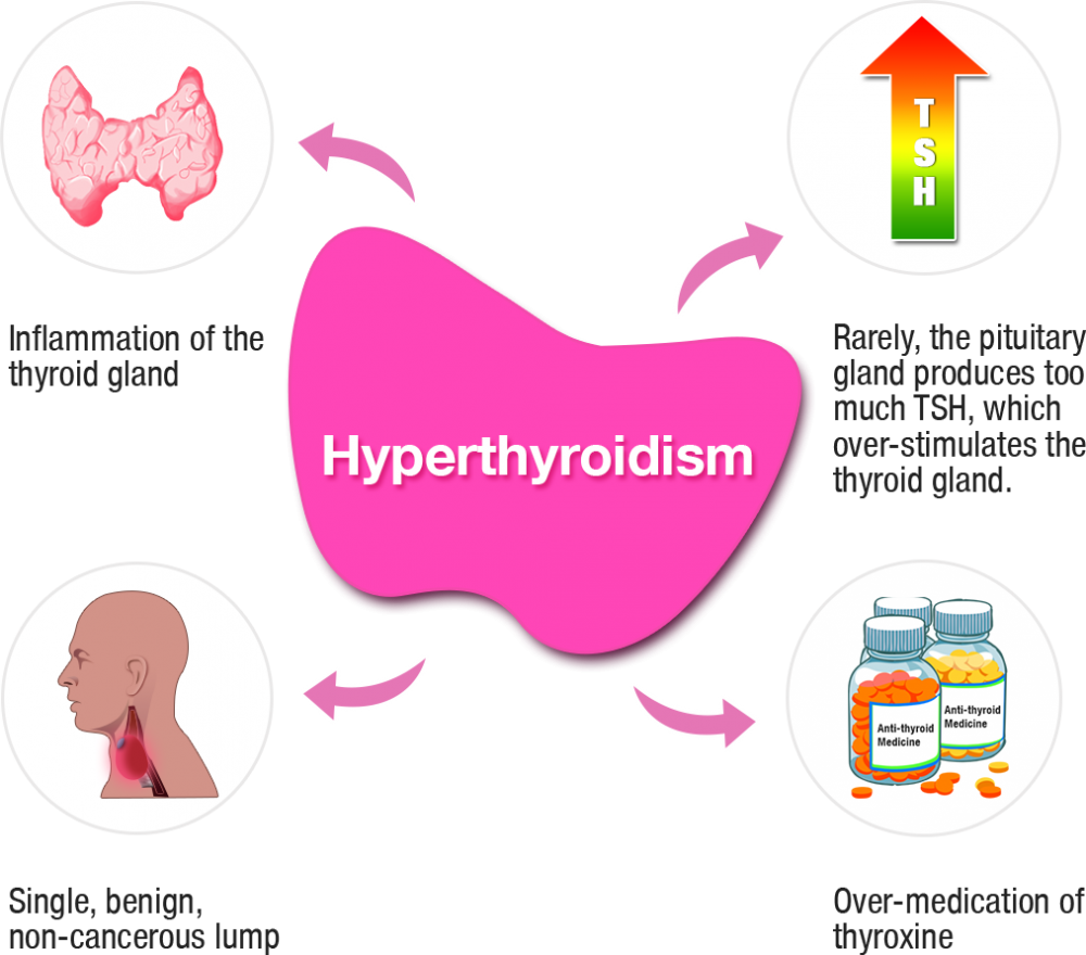 Rawatan Penyakit Tiroid : Bagaimana Resveratrol Membantu Bagi Impak ...