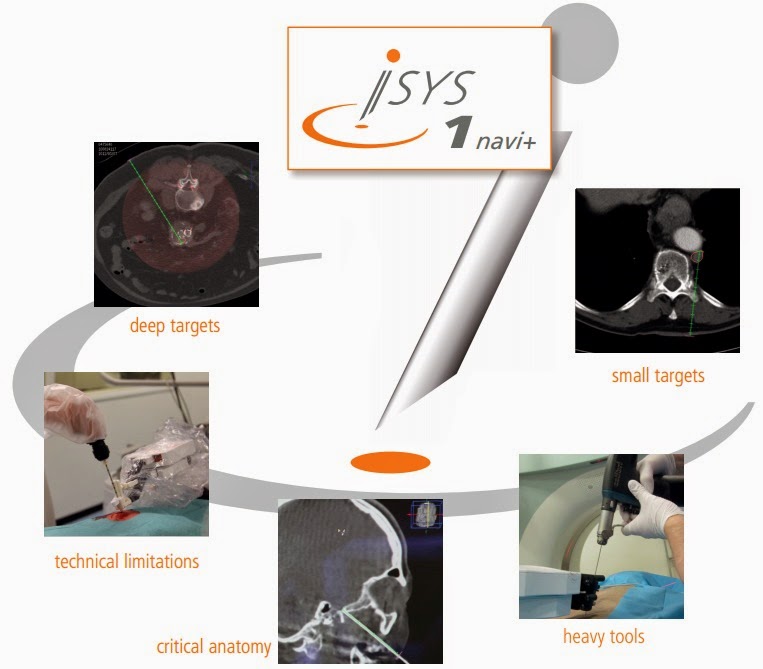 iSYS 1 robot is now FDA cleared