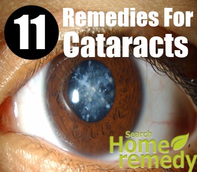 11 HERBAL REMEDIES FOR CATARACTS ~ Mzizi Mkavu