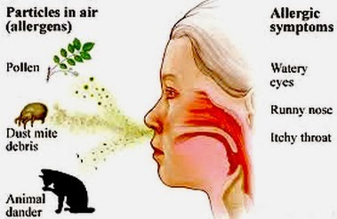 ΕΥίασις Ear nose & throat IΝSTITUTE : Allergic Rhinitis