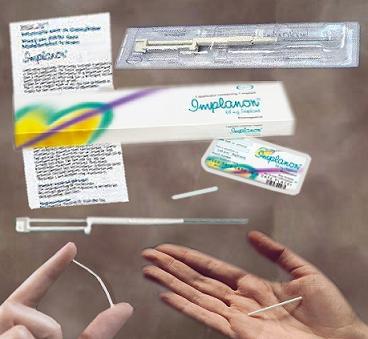 Anticonceptivos y ETSs: IMPLANTE HORMONAL