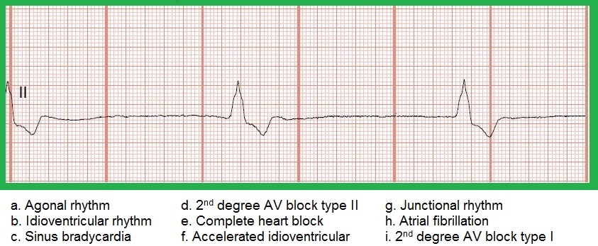 Float Nurse: Slow Rhythms Quiz
