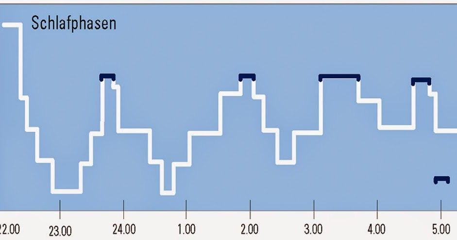 Ist Das Ein Traum: Träume