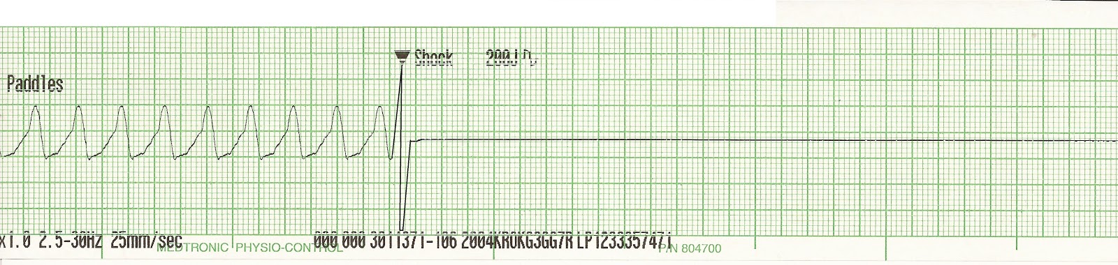 Electrical Interventions