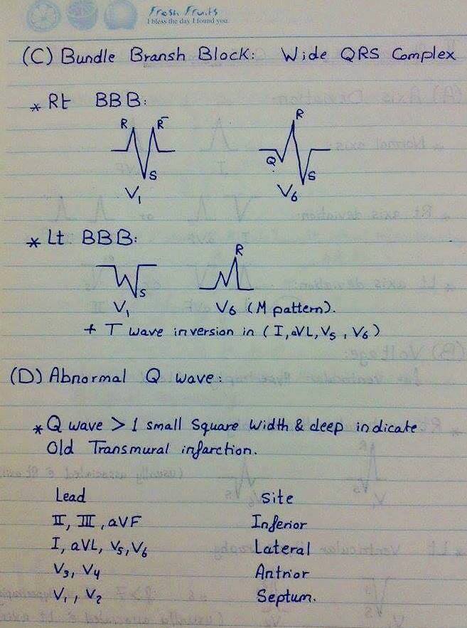 ال ECG في 22 صفحة