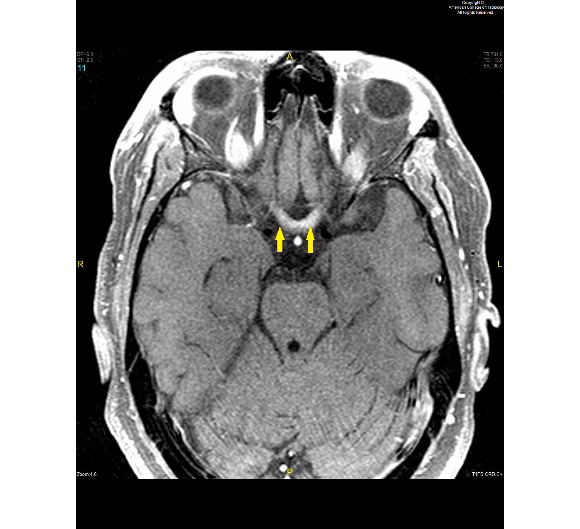 EL RINCÓN DE LA MEDICINA INTERNA. juanpedromacaluso@yahoo.com.ar ...