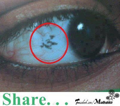 Allah Name on Human Body ~ Islamic Miracles