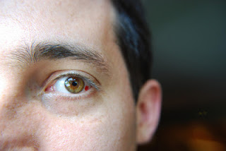 Bleeding in My Eye | Stardust....