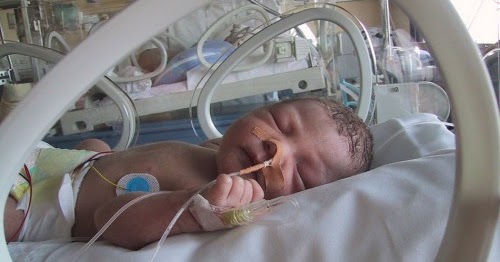 RED LATINOAMERICANA DE PEDIATRÍA Y NEONATOLOGÍA: Biomarcadores para el ...