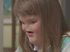 Inspirational Bursts: Cassidy Hooper: The girl who was born without ...