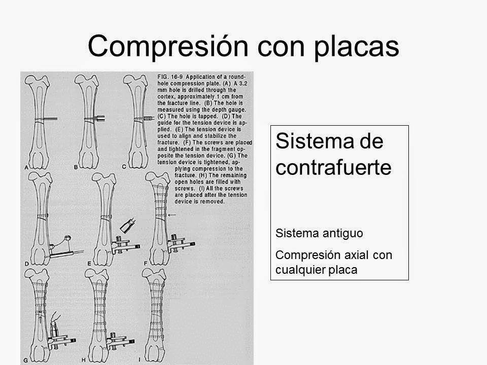 Gaceta de Instrumental, Implantes y Osteosíntesis: Principios de ...