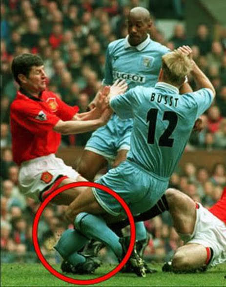 World Wide News - All Around The WORLD: Worst Injuries While Playing Games