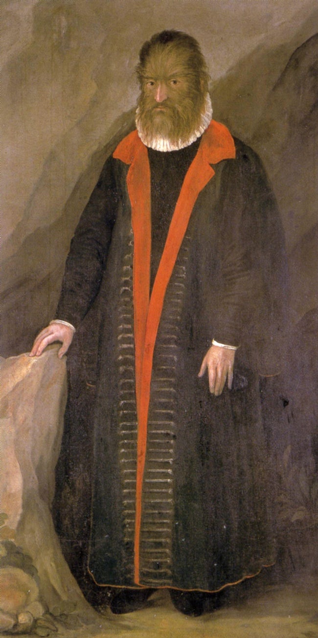 Cuplul real care a inspirat „Frumoasa și bestia” a dus o viață extrem ...