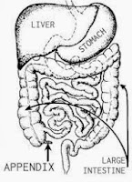 Le Défi en diagnostic d'appendicite chronique - Articles à propos de la ...