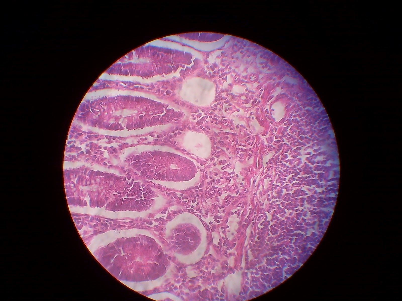 Ca - CaDo (Catatan Calon Dokter): Blok 13 : Praktikum Patologi Anatomi ...