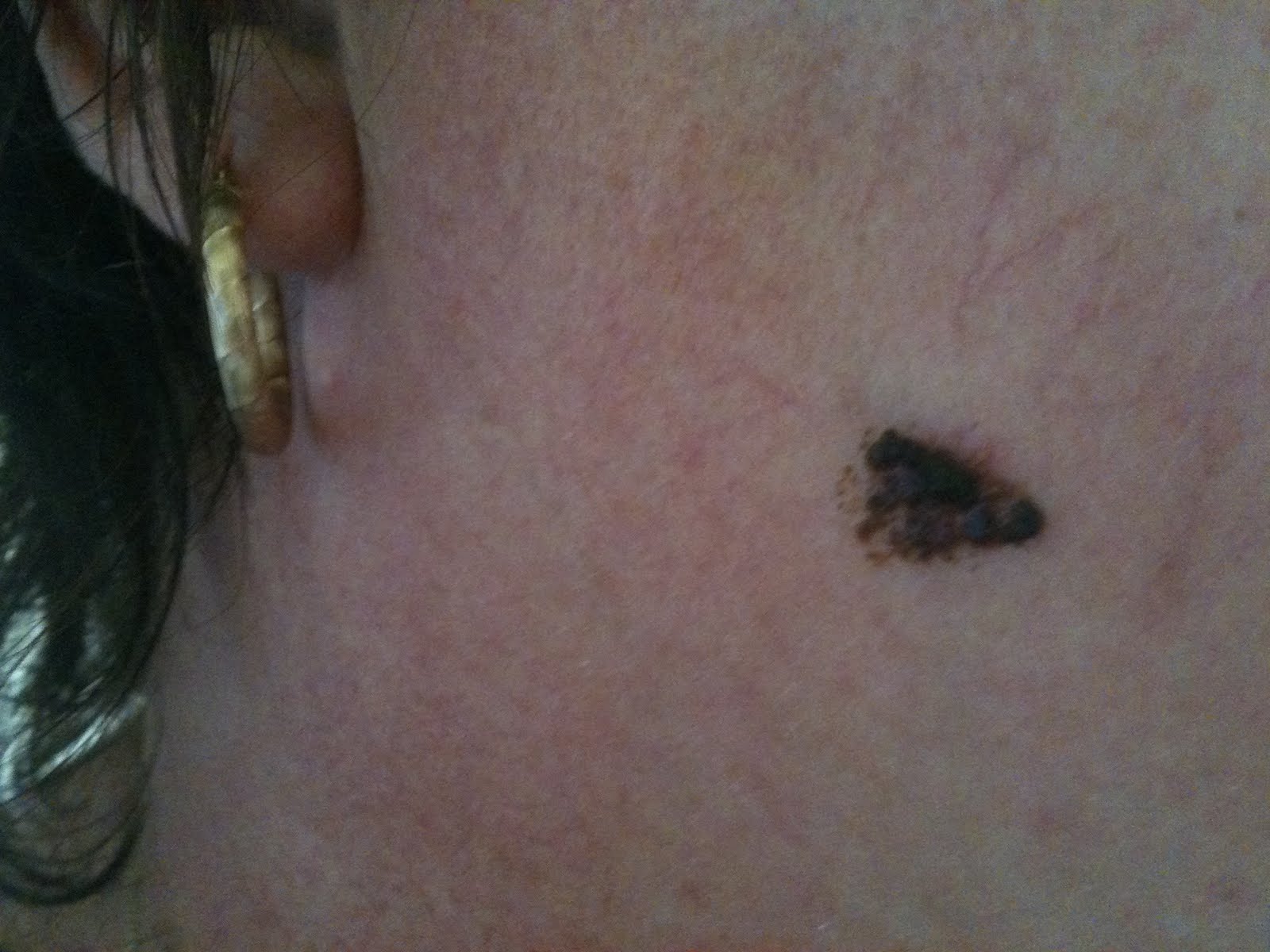 BLACK SALVE - My Experience