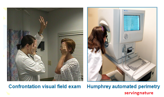 Healthy Body-Healthy Mind: Visual Field Determination