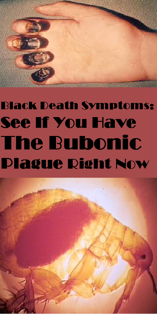 Black Death Symptoms: See If You Have The Bubonic Plague Right Now ...