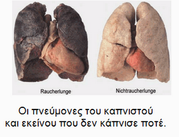 ΥΛΙΚΟ ΜΑΘΗΜΑΤΩΝ: ΒΙΟΛΟΓΙΑ Α ΓΥΜΝΑΣΙΟΥ: Πνεύμονες καπνιστή και πνεύμονες ...