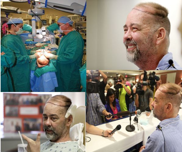 Amyzanys` blog: "I` Am Forever Grateful To Surgeon" Says Man Who ...