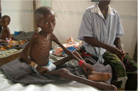 Cansei de Ser Fofa: Passar fome sem ter opção