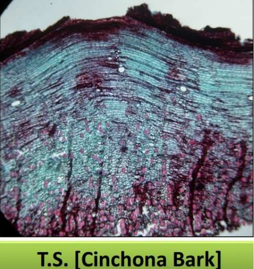 Cinchona Bark Microscopy