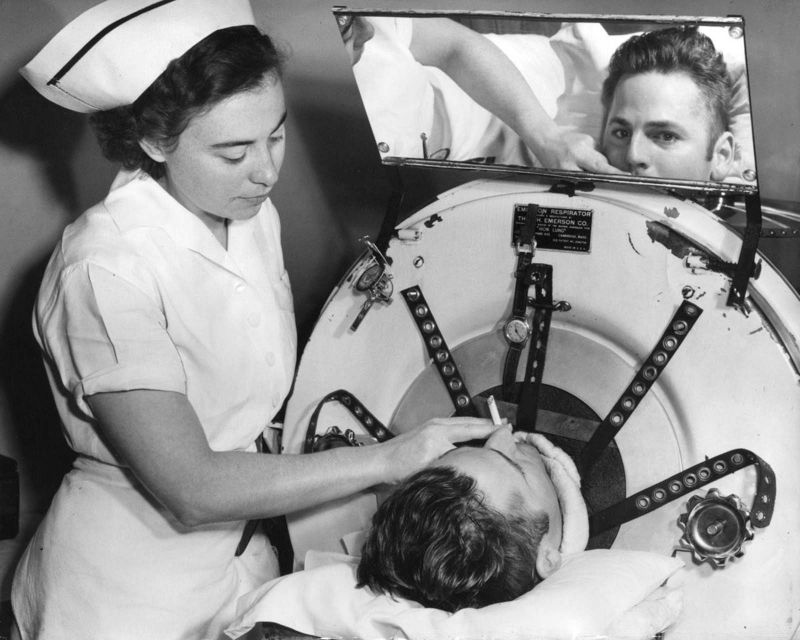 20 Vintage Photos of Iron Lungs for Polio Victims From Between the 1930s and 1950s ~ Vintage ...