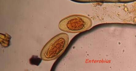 TRAJETÓRIA DE UMA NUTRICIONISTA: PARASITOLOGIA - ENTEROBIUS VERMICULARIS