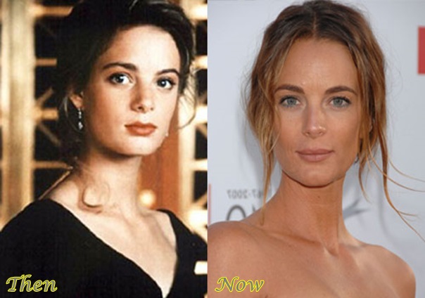 Celebplasticsurgerygossip: Gabrielle Anwar plastic surgery-she still ...